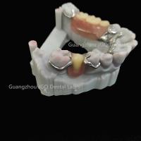 China Durable Metal Framework Dentures Removable 3D Printing Process for sale