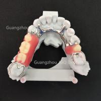 China Durable Metal Framework Dentures Removable 3D Printing Process for sale