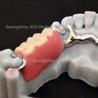 China Durable Metal Framework Dentures Removable 3D Printing Process for sale