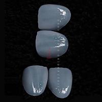 China Porcelain Dental Emax Veneers Zirconia Crowns Easy to Adjust Customized for sale