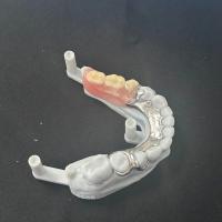 China Co Cr Alloy Removable Dentures DSD Aesthetic Design Acrylic Dentures Customized for sale