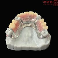 China Co Cr Alloy Removable Dentures DSD Aesthetic Design Acrylic Dentures Customized for sale