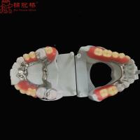 China Co Cr Alloy Removable Dentures DSD Aesthetic Design Acrylic Dentures Customized for sale
