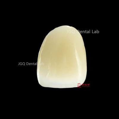 China Natural Aesthetics Zirconia Crown with 1200 MPa Flexural Strength and Customized Design for Dental Restorations for sale
