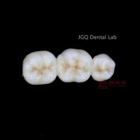 China Natural Aesthetics Zirconia Crown with 1200 MPa Flexural Strength and Customized Design for Dental Restorations for sale