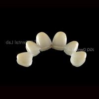 China Natural Aesthetics Zirconia Crown with 1200 MPa Flexural Strength and Customized Design for Dental Restorations for sale