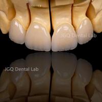 China Digital Milled Zirconia Crown And Bridges Fast Turnaround China Dental Lab for sale