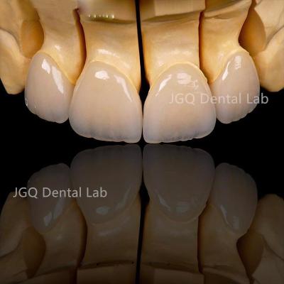 China Digital Milled Zirconia Crown And Bridges Fast Turnaround China Dental Lab for sale