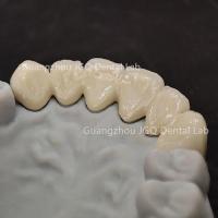 China Digital Milled Zirconia Crown And Bridges Fast Turnaround China Dental Lab for sale