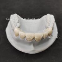 China Digital Milled Zirconia Crown And Bridges Fast Turnaround China Dental Lab for sale
