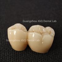 China Safe Certified Zirconia Non Irritating Material for All Oral Conditions Professional Dental Lab for sale