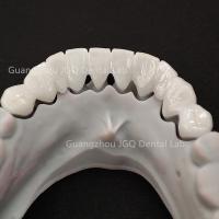 China Premium Aesthetic and Functional Zirconia Integrated Dental Restoration Craft for sale