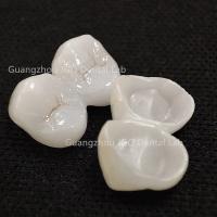 China Premium Aesthetic and Functional Zirconia Integrated Dental Restoration Craft for sale