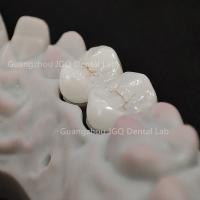 China Premium Aesthetic and Functional Zirconia Integrated Dental Restoration Craft for sale