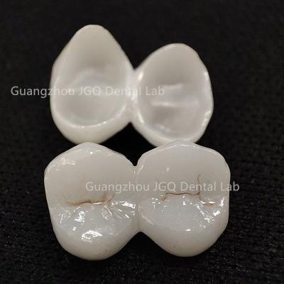 China DA CE Approved Zirconia Prosthetics Reliable Dental Laboratory Craft for sale