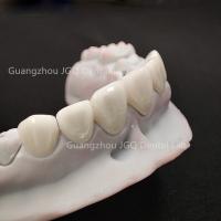 China Customized Dental Laminate Veneers and Zirconia Crown with Fast Turnaround and Biocompatible Materials for sale