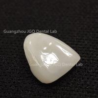China Customized Dental Laminate Veneers and Zirconia Crown with Fast Turnaround and Biocompatible Materials for sale