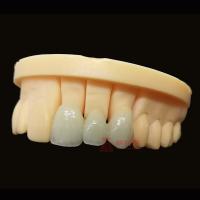 China Aesthetic Layered  Monolithic Bulk Zirconia Customizable to Your Clinic Needs for sale