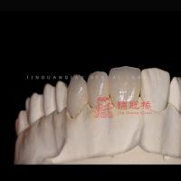 China Aesthetic Layered  Monolithic Bulk Zirconia Customizable to Your Clinic Needs for sale