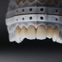 China Aesthetic Layered  Monolithic Bulk Zirconia Customizable to Your Clinic Needs for sale