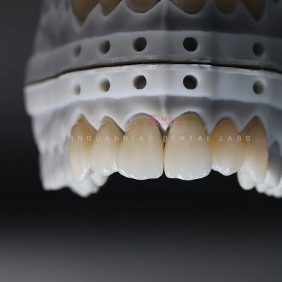 China Aesthetic Layered  Monolithic Bulk Zirconia Customizable to Your Clinic Needs for sale