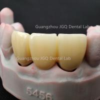 China Professional Guangzhou Dental Manufacturer Premium Zirconia Solutions High Aesthetic  Anterior Smile Design for sale
