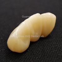 China Professional Guangzhou Dental Manufacturer Premium Zirconia Solutions High Aesthetic  Anterior Smile Design for sale