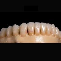 China China Leading Dental Lab Supply High Quality Bulk Zirconia Restorations with Reliable Outsourcing Services for sale