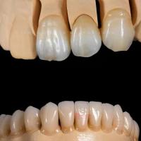 China China Leading Dental Lab Supply High Quality Bulk Zirconia Restorations with Reliable Outsourcing Services for sale