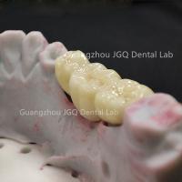 China Custom Solid Layered Zirconia Crown Bridge Full Service China Dental Lab for sale