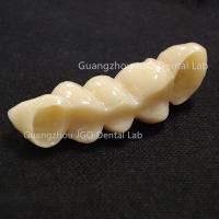 China Custom Solid Layered Zirconia Crown Bridge Full Service China Dental Lab for sale