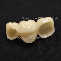China China Leading Dental Lab Supply High Quality Bulk Zirconia Restorations with Reliable Outsourcing Services for sale