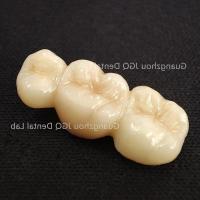 China Custom Dental Lab Zirconia Crown Bridge Fabrication Stable Restoration for sale