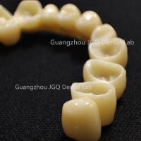 China Custom Dental Lab Zirconia Crown Bridge Fabrication Stable Restoration for sale
