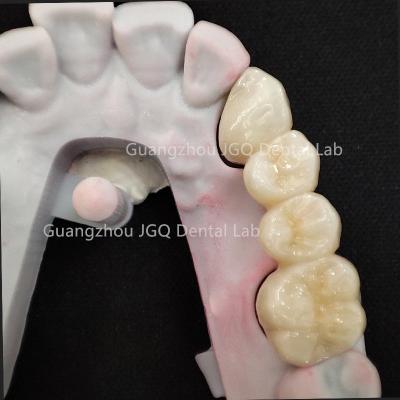 China High-Purity Bulk Zirconia 33 Years Experience 11 Labs Across China  Fast Turnaround for sale