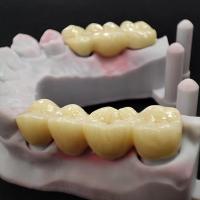 China Medical Grade Zirconia Crowns Full Contour Stained Polished for Broken Teeth for sale