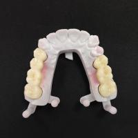 China Medical Grade Zirconia Crowns Full Contour Stained Polished for Broken Teeth for sale