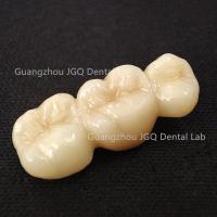 China Custom Layered Zirconia Perfect Shade Matching for Front Teeth Dental Manufacturer Stable Lab Partnership Worldwide for sale