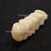 China Custom Layered Zirconia Perfect Shade Matching for Front Teeth Dental Manufacturer Stable Lab Partnership Worldwide for sale