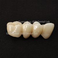 China Dental Lab China High Esthetics Full Contour Crown Dental Zirconia Bridge for sale