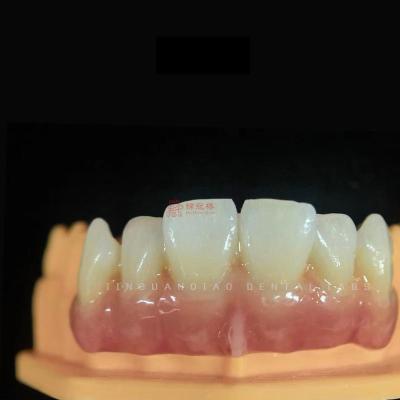 China Natural Translucent Zirconia Restorations Custom Designed For Anterior Teeth for sale