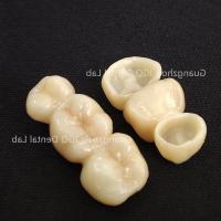 China Natural Translucent Zirconia Seamless Integration with Natural Dentition Experienced Dental Manufacturer Good Price for sale