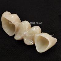China Natural Translucent Zirconia Seamless Integration with Natural Dentition Experienced Dental Manufacturer Good Price for sale