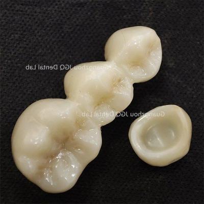 China All Ceramic Crown Bridge Dental Laboratory Natural Looking With Aesthetic Effect for sale