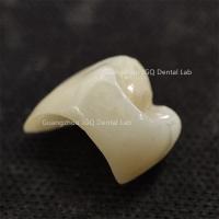 China All Ceramic Crown Bridge Dental Laboratory Natural Looking With Aesthetic Effect for sale