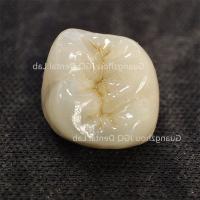 China All Ceramic Crown Bridge Dental Laboratory Natural Looking With Aesthetic Effect for sale