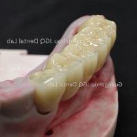 China Natural Translucent Zirconia Seamless Integration with Natural Dentition Experienced Dental Manufacturer Good Price for sale