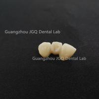 China Custom Layered Zirconia Perfect Shade Matching for Front Teeth Dental Manufacturer Stable Lab Partnership Worldwide for sale