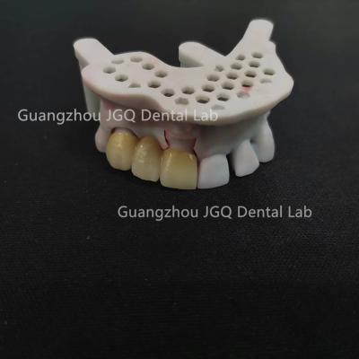 China Custom Layered Zirconia Perfect Shade Matching for Front Teeth Dental Manufacturer Stable Lab Partnership Worldwide for sale