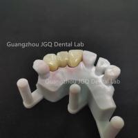 China Custom Layered Zirconia Perfect Shade Matching for Front Teeth Dental Manufacturer Stable Lab Partnership Worldwide for sale